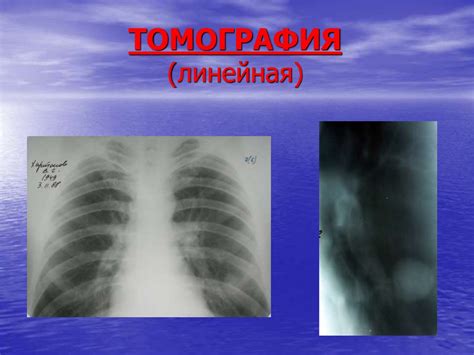 Принципы и методы лучевой диагностики Роль и задачи лучевой диагностики в общеклиническом