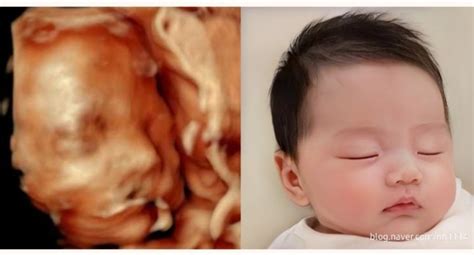 임신일기 W28 임신8개월진입 입체초음파 베이비페이스 네이버 블로그