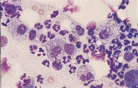 Monocytes Overview Quantity Morphology Ivis