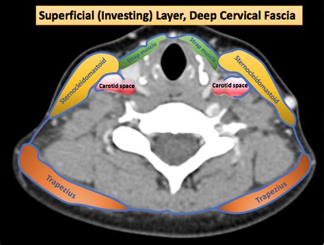 Superficial Layer Of The Deep Cervical Fascia Pacs