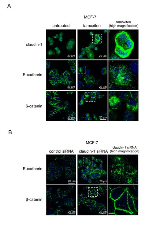 Subcellular Localization Of Claudin 1 E Cadherin And β Catenin In