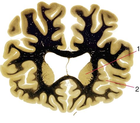 Cortex Coronal Cross Sections Diagram Quizlet