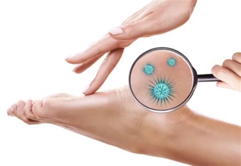 Kërpudhat Armiku I Padukshëm Që Fshihet Kudo Shendet Bukuri