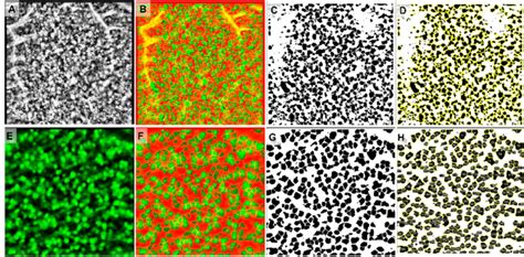 visualization of automatic detection and quantification steps of rgc download scientific