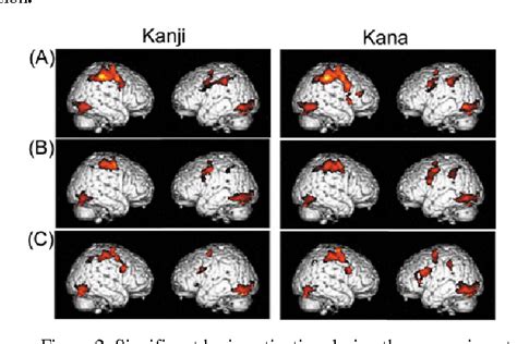 figure 2 from implicit and explicit processing of kanji and kana words