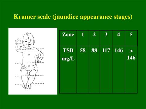 Cramers Rule Jaundice At Reginald Hopkins Blog