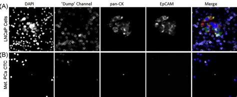 Limitations To Size Based Ctc Enrichment Patient Ctcs Vs Cell Lines