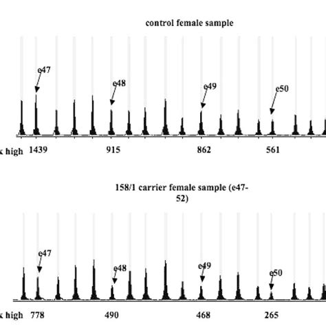 Mlpa Analysis Of The Dystrophin Gene Using Capillary Electrophoresis