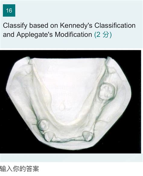 16 Classify Based On Kennedys Classification Studyx 16 Classify Based On Kennedys Classification Studyx
