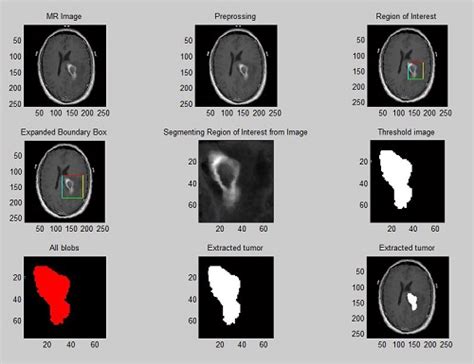Brain Tumor Segmentation With Deep Neural Networks