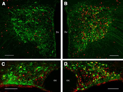 Acute Hypernatremia Followed By Restraint Activates Ot Containing