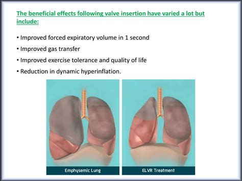 Collateral Ventilation Pptx