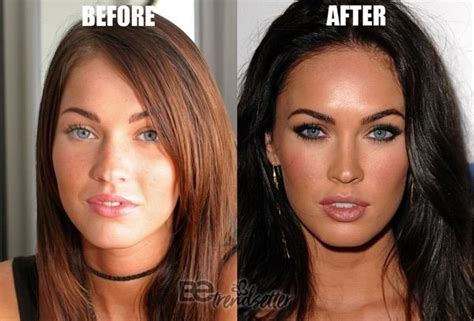 Megan Fox Teeth Megan Fox Lips Megan Fox Before After Megan Fox