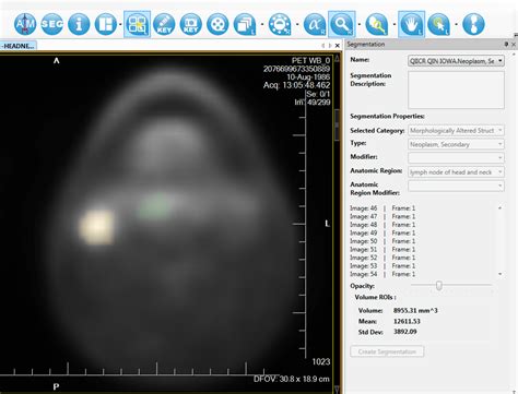 Aim On Clearcanvas Dicom4qi Aim On Clearcanvas Dicom4qi