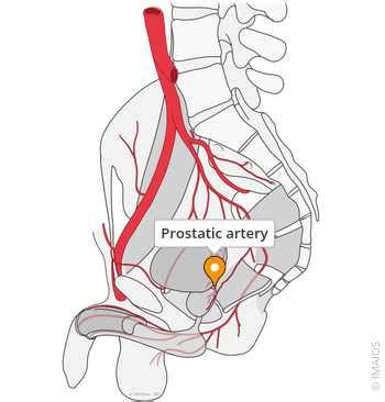 Prostatic Artery E Anatomy Imaios