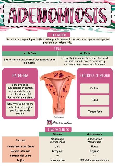 Adenomiosis Alicia En Medicina By Gabriela Soplin Villacorta Udocz