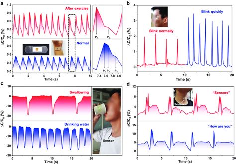 Application In Recognition Of Physiological Signals A Relative Download Scientific Diagram
