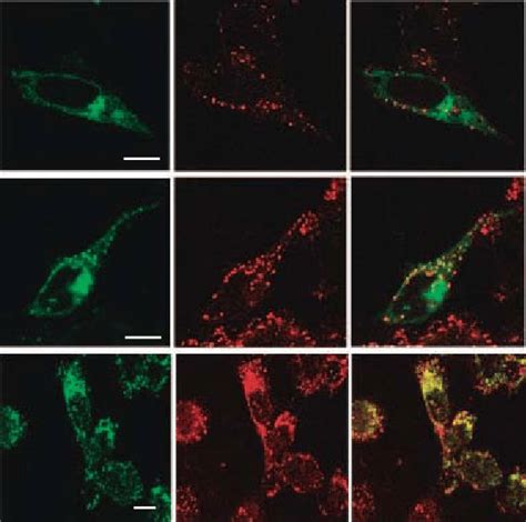 Intracellular Localization Of Chimeric Proteins The Chimeric Gfp And