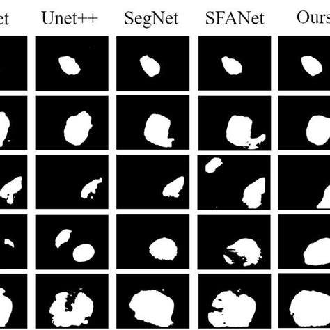 Visual Comparison Of Polyp Region Segmentation From State Of The Art