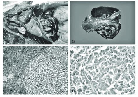 Macroscopic A And B And Microscopic C And D Characteristics Of Macroscopic A And B And Microscopic C And D Characteristics Of