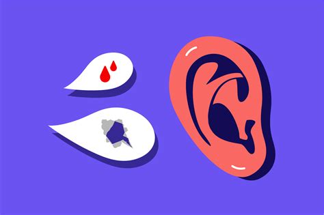 처녀막 진짜로 존재할까