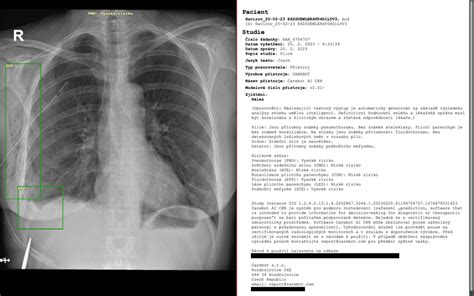 A Demonstration Of The Proposed Dlad Carebot Ai Cxr Implemented In