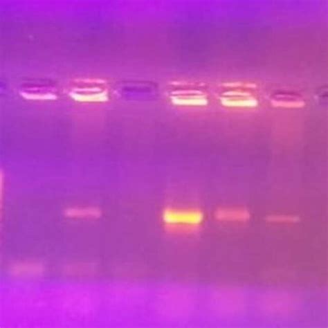 Gel Electrophoresis Of Pcr Amplified Pvl Gene 433 Bp Among Ca Mrsa