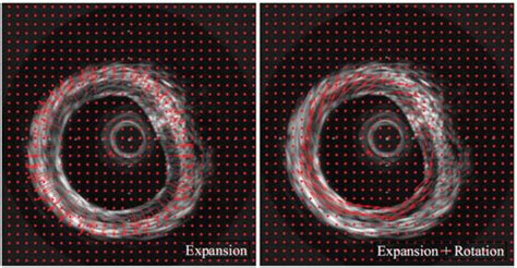 Examples Of Calculated Displacement Field After Image Registration In