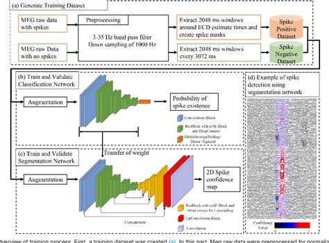 Figure 1 From Fully Automated Spike Detection And Dipole Analysis Of