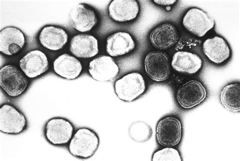 Free Picture Vaccinia Virions Virion Single Complete Infectious Virus Particle