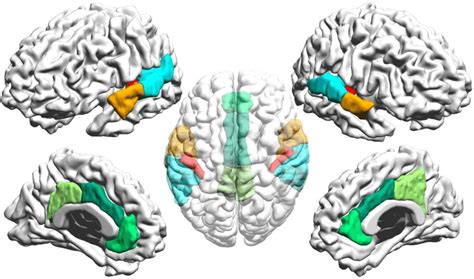 Superior Temporal Gyrus
