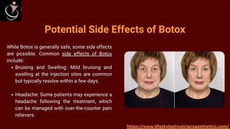 Ppt Botox Injections Treatment Recovery And Side Effects Lifestyles