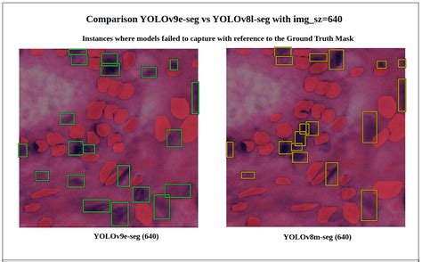 Yolov9 Instance Segmentation On Medical Dataset
