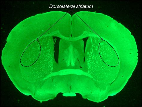 New Insight On How The Brain Forms Habits National Institute On