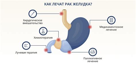 Способы лечения рака