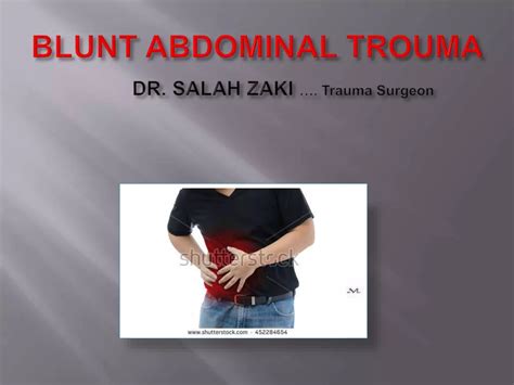 Blunt Abdominal Trauma PPTX