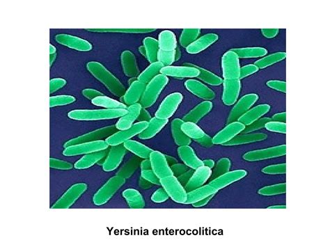 Enterobacteriaceae Nonlactosefermentation Ppt