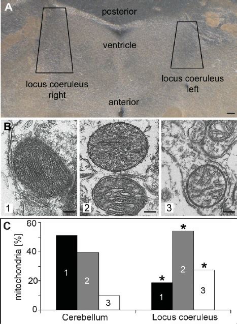 Mitochondrial Morphology In Brains Of Mice With A Conditional Knock Out