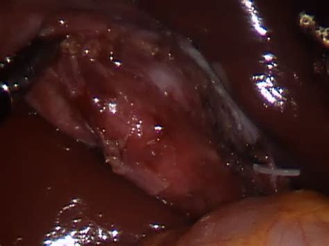 Clinical Robotic Surgery Association