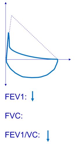 Spirometry Interpretation Flashcards Quizlet