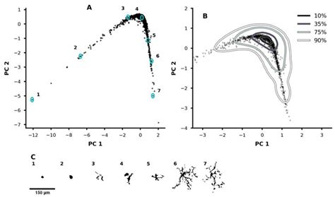 Automated Segmentation And Analysis Of Retinal Microglia Within Imagej Pmc