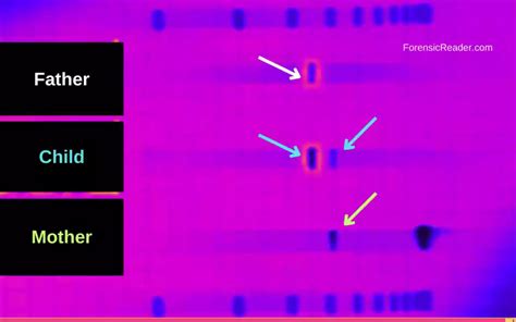 [6 Tests] Disputed Paternity And Maternity Tests In Forensic