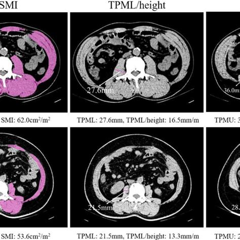 A Correlation Between Tpmlheight And L3 Smi B Correlation Between
