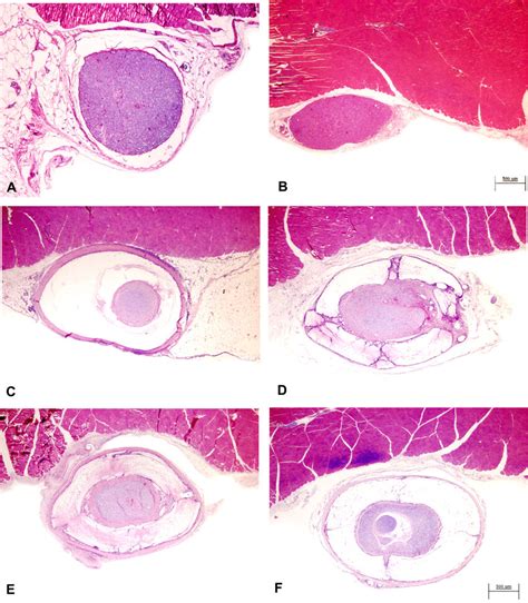 Images Show Cross Sections Of The Sciatic Nerve In The Middle Portion