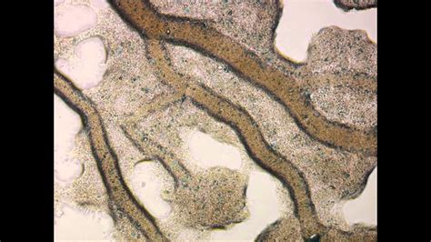 Physarum Under Microscope