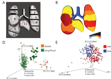 Host Microbe Interactions On Twitter Spatial Metabolomics Reveals Localized Impact Of