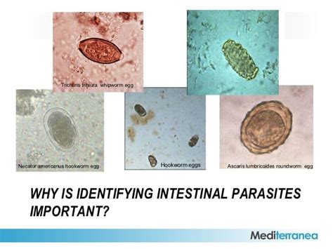 Colon Parasites