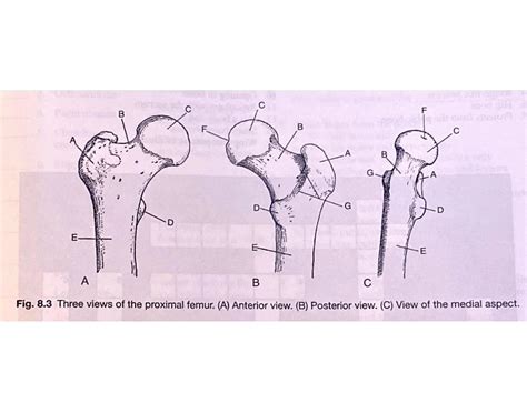 Pelvis And Hip Proximal Right Femur Views Quiz