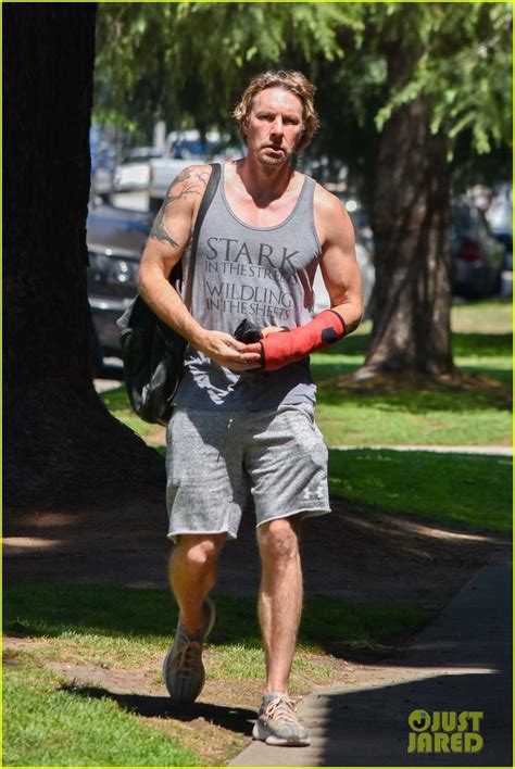Dax Shepard Steps Out In A Cast After Performing Surgery On Himself