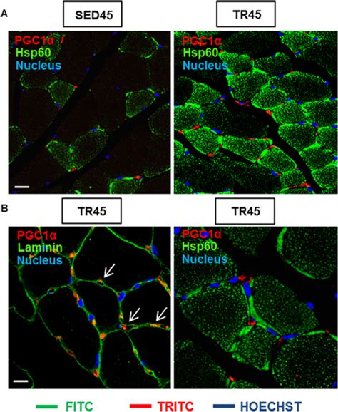 The Confocal Microscopy Analysis Shows The Localization Of Pgc1α